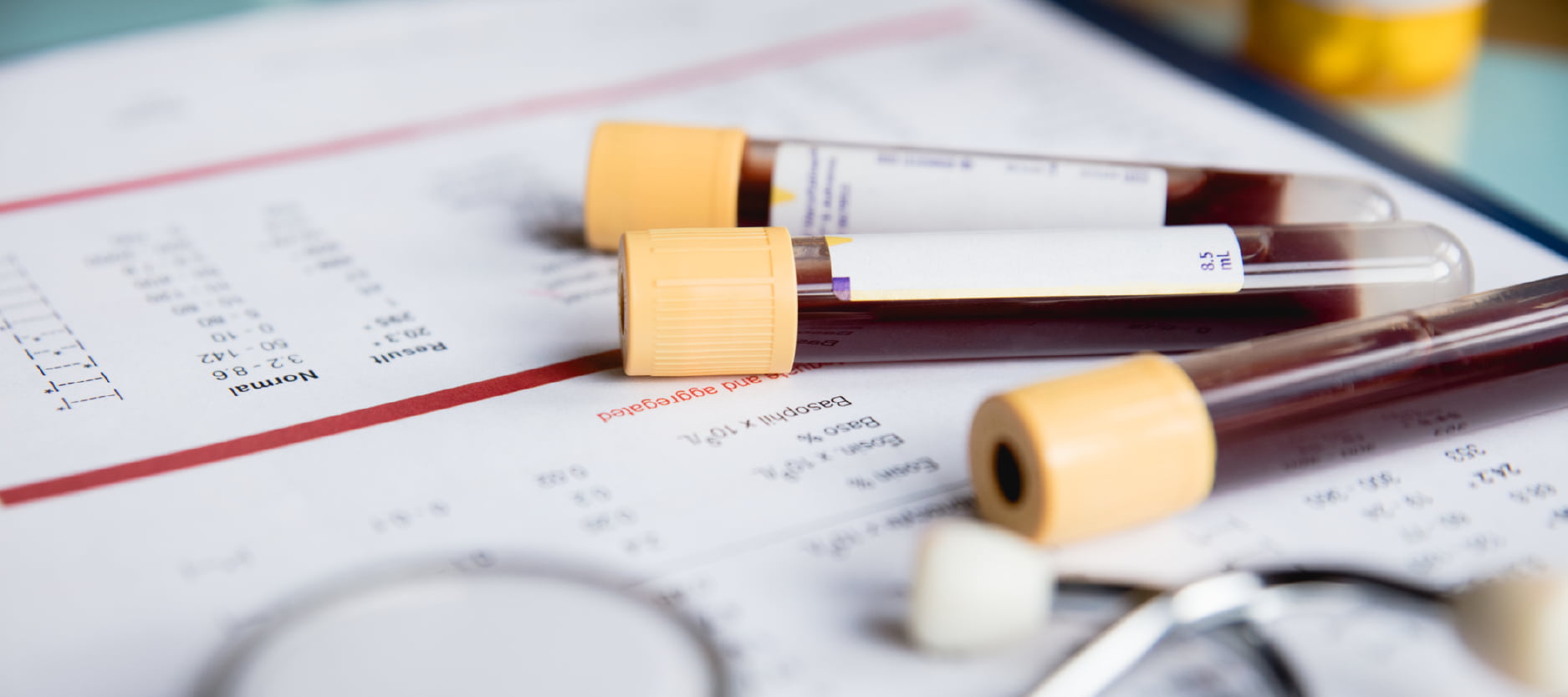 What Blood Tests Detect Heart Problems Imaware